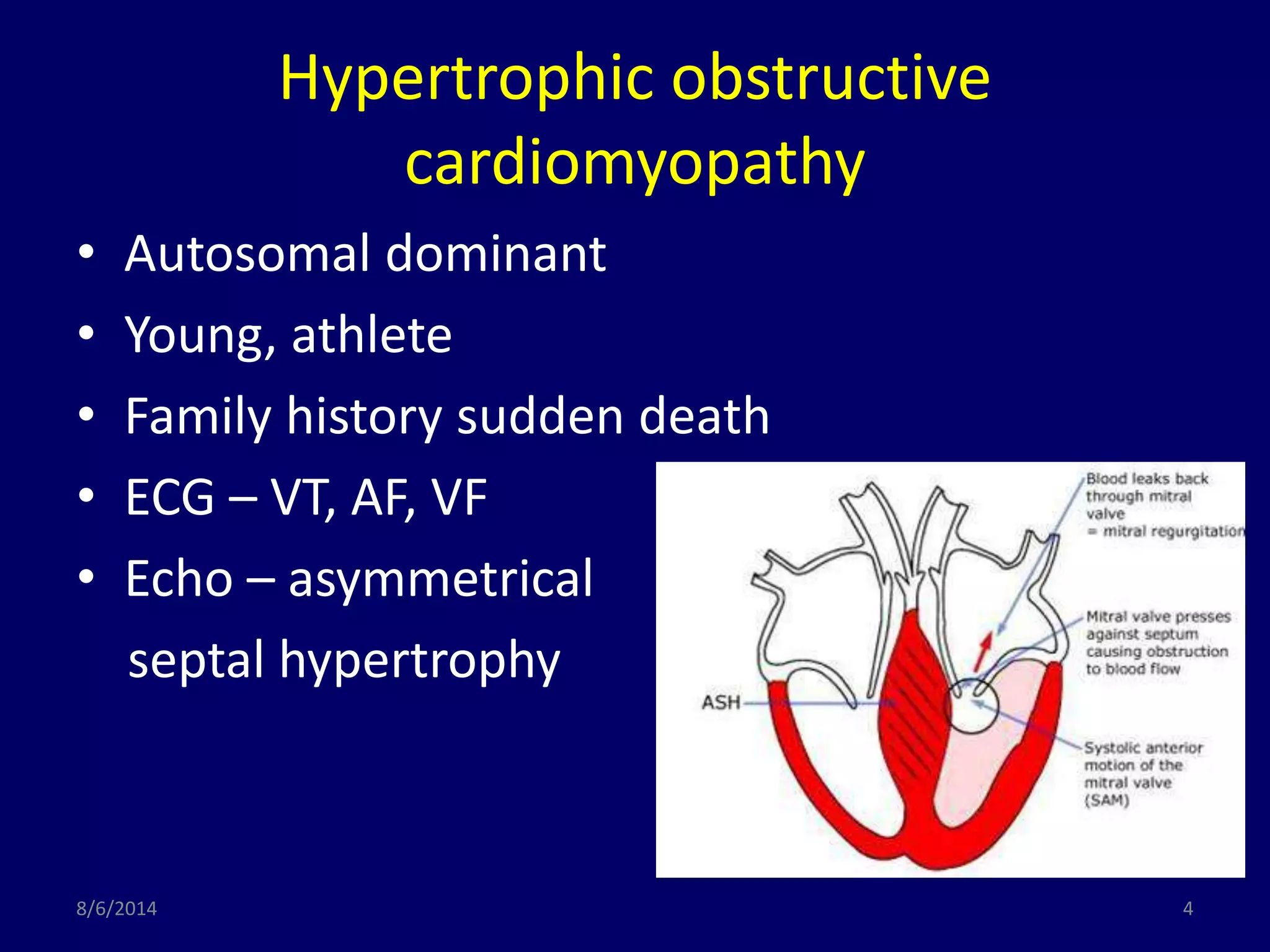 Sudden cardiac death | PPTX