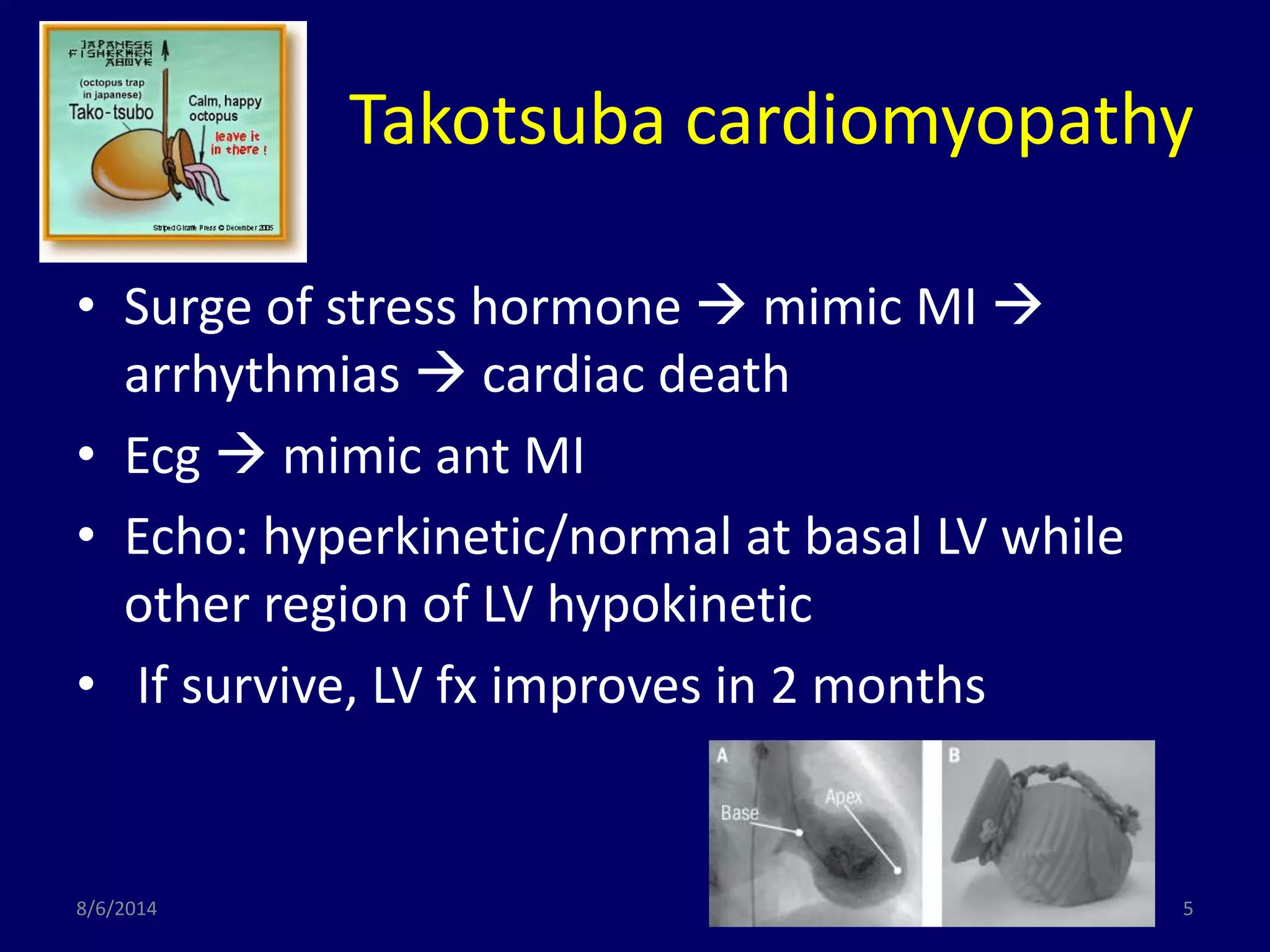 Sudden cardiac death | PPTX