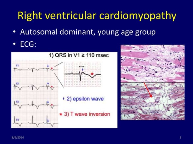 Sudden cardiac death | PPTX