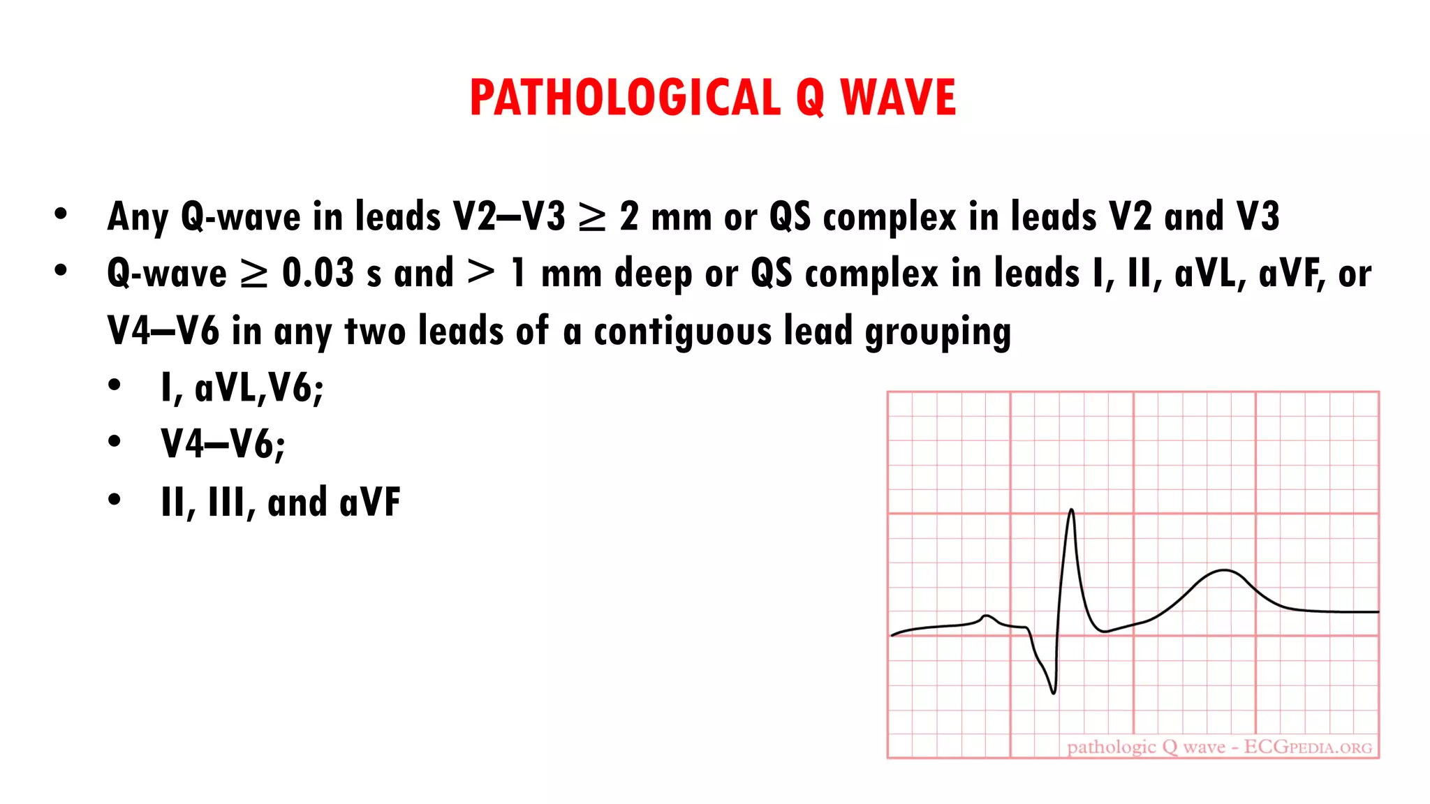 SUDDEN CARDIAC DEATH@.pdf