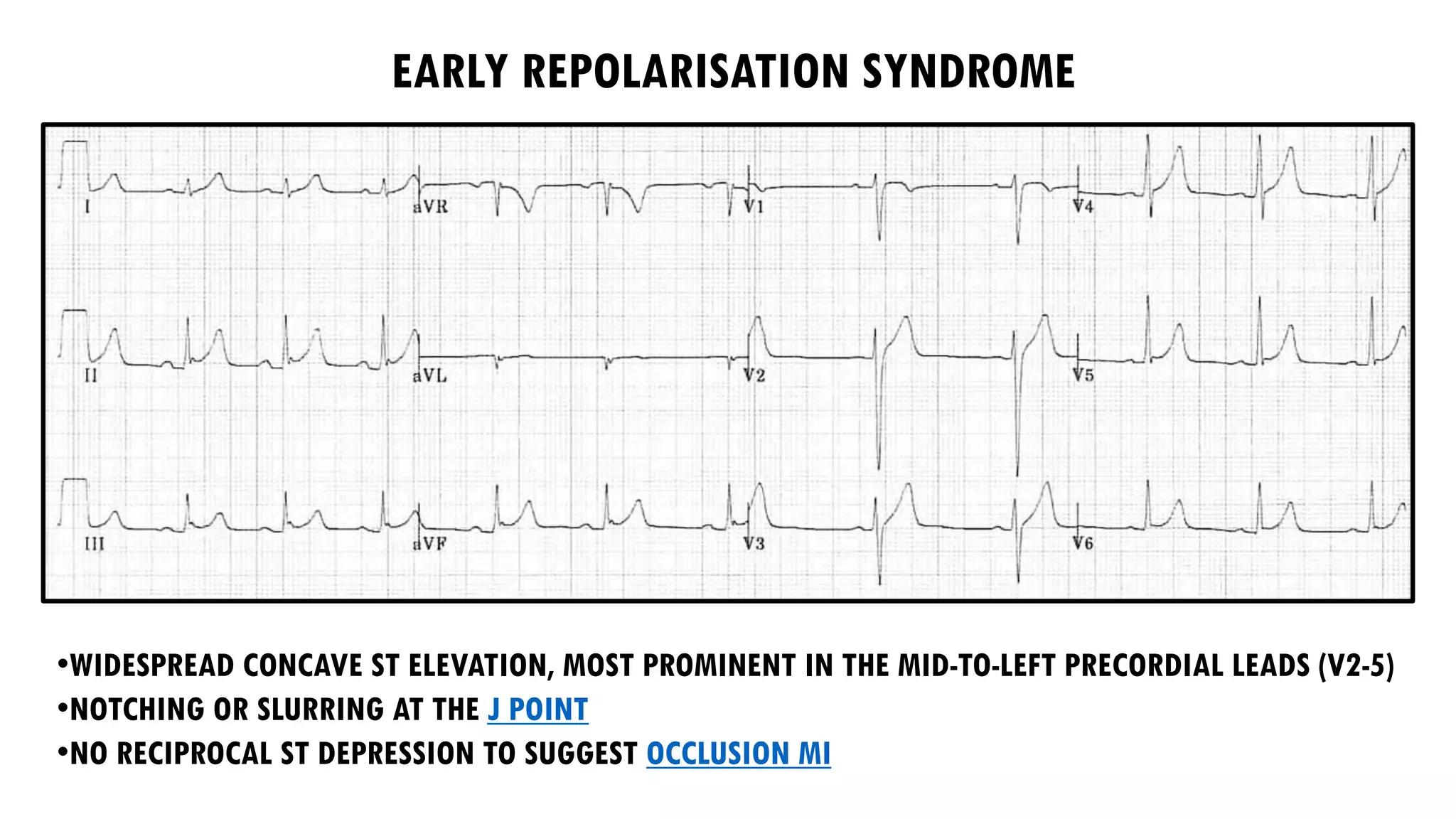 SUDDEN CARDIAC DEATH@.pdf