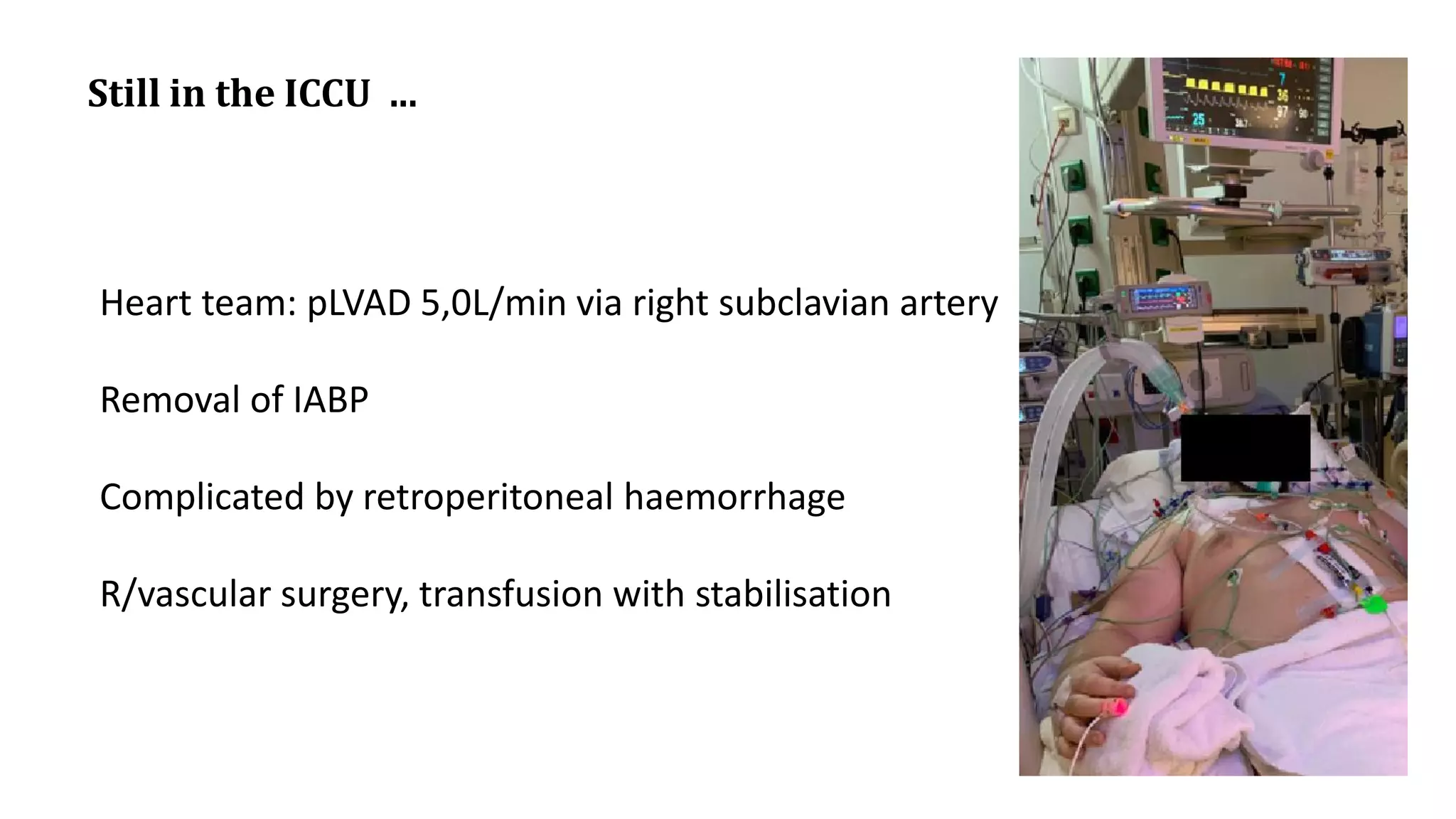 Sudden cardiac death and cardiogenic shock a team approach to save ...