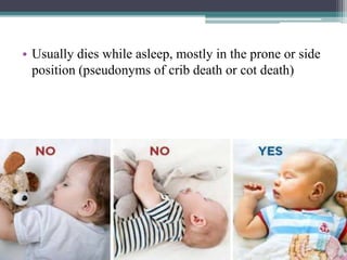Sudden unexpected death in infancy | PPTX