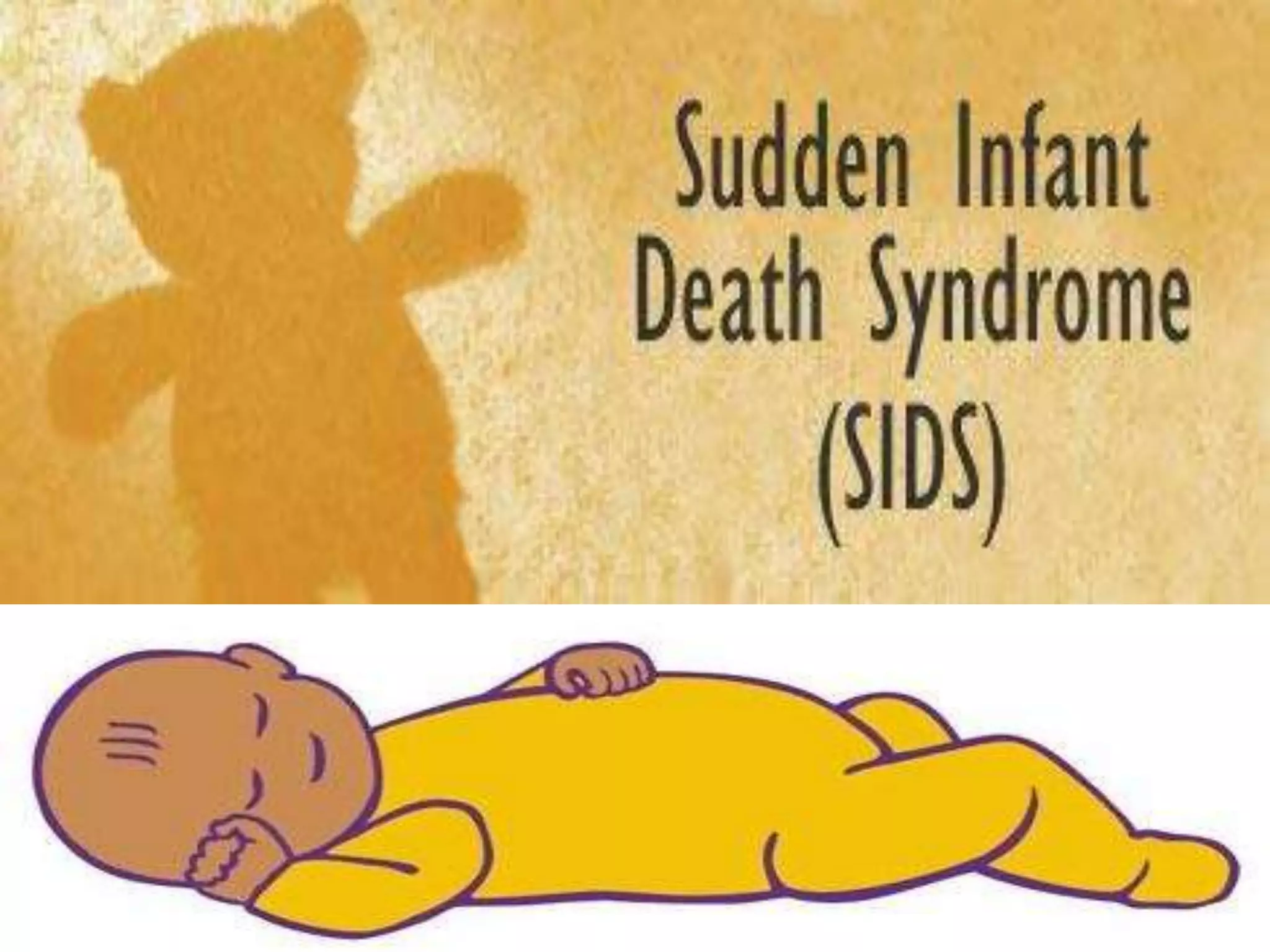 Sudden Infant Death Syndrome (SIDS) | PPTX