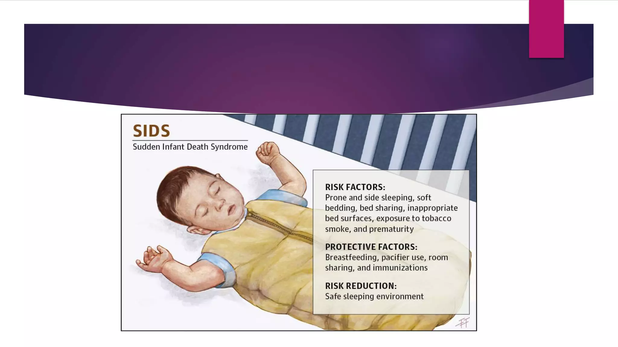 Sudden infant death syndrome(SIDS)- By RxVichu!! ;) ;) | PPTX