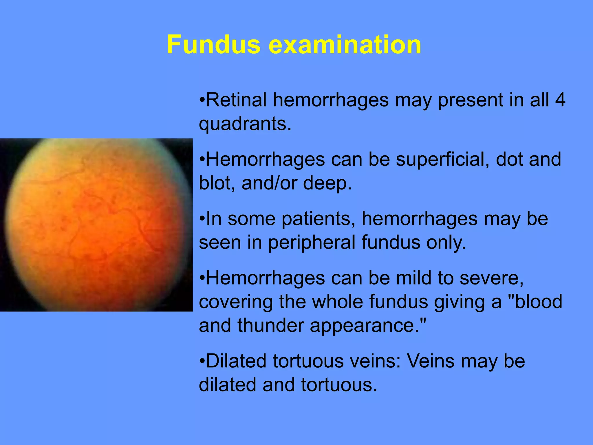 Sudden loss of vision IN A PATIENT ACUTELY | PPT