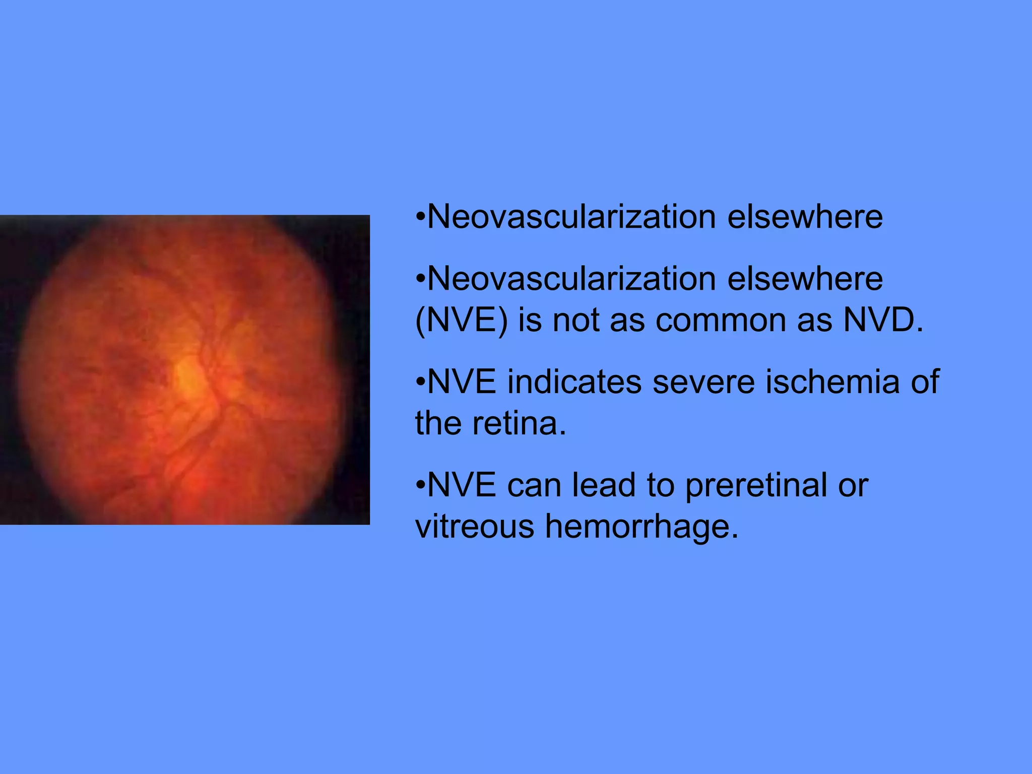 Sudden loss of vision IN A PATIENT ACUTELY | PPT