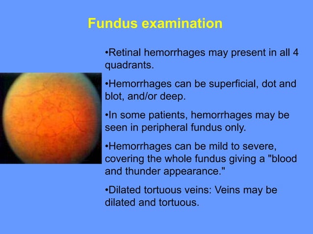 Sudden loss of vision IN A PATIENT ACUTELY | PPT