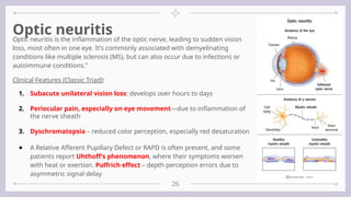 Sudden loss of vision................... | PPTX