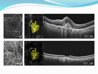 Sudden Loss of Vision Differential Diagnosis | PPT