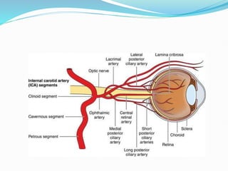 Sudden Loss of Vision Differential Diagnosis | PPT