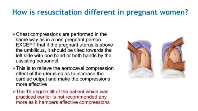 Sudden Maternal Collapse - Understanding Causes and Emergency ...