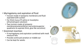 Sudden sensory neural hearing loss | PPTX