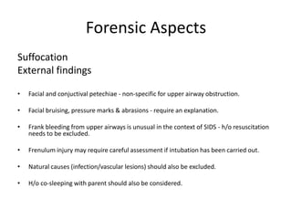 Sudden unexpected death in infancy | PPTX