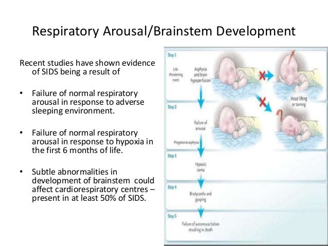 Sudden unexpected death in infancy