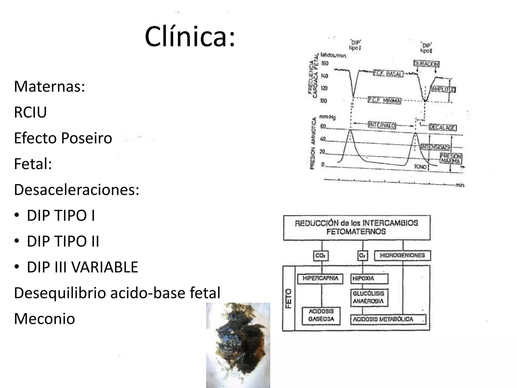 Sufrimiento fetal | PPTX