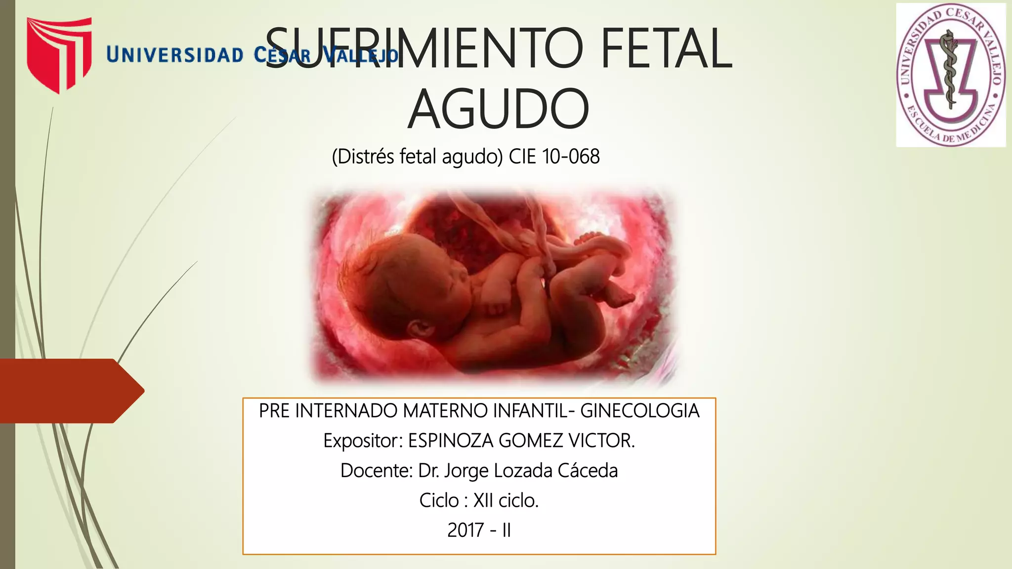 Sufrimiento Fetal Causas