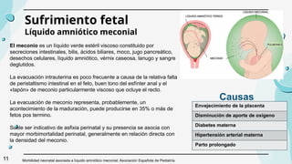 Estado fetal no tranquilizador . Sufrimiento fetal | PPTX