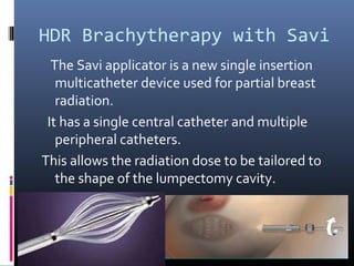 clinical applications of ldr and hdr brachytherapy | PPT