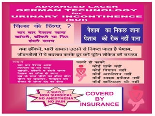 Stress Urinary Incontinence (SUI) : Dr Sharda Jain | PPTX