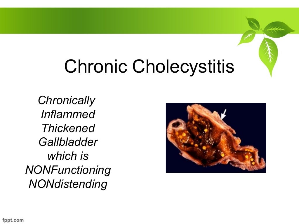 Acute and Chronic Cholecystitis