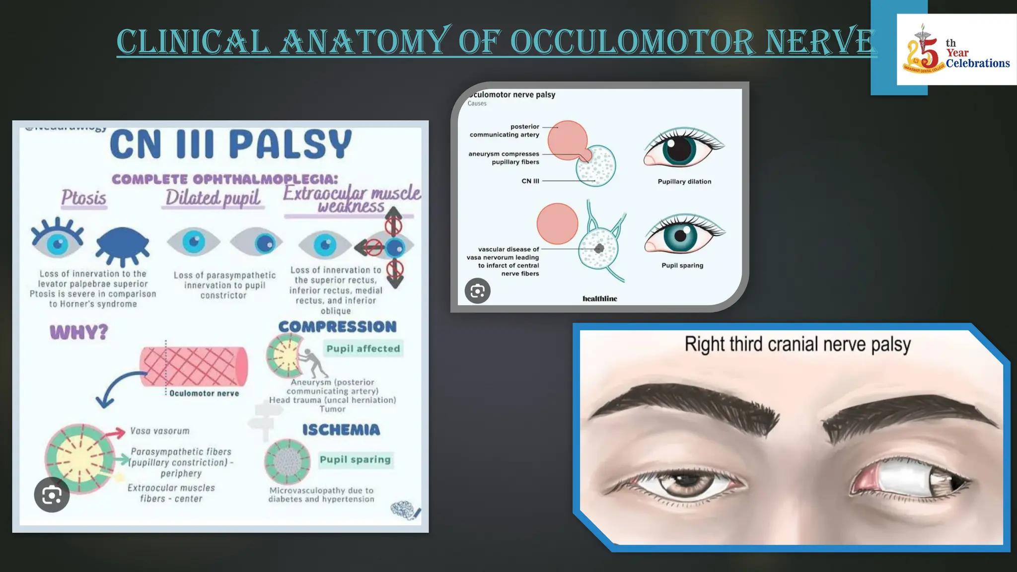 NERVES OF ORBIT AND CLINICAL ANATOMY (ANATOMY) BDS STUDENT | PPTX
