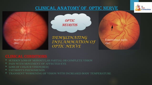 NERVES OF ORBIT AND CLINICAL ANATOMY (ANATOMY) BDS STUDENT | PPTX