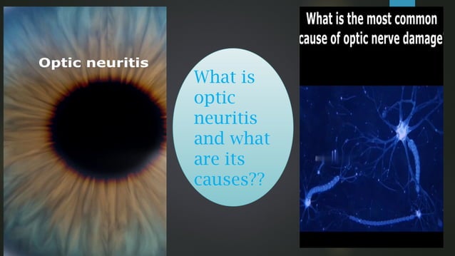 NERVES OF ORBIT AND CLINICAL ANATOMY (ANATOMY) BDS STUDENT | PPTX