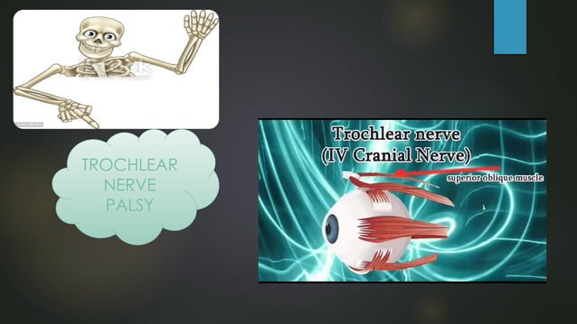 NERVES OF ORBIT AND CLINICAL ANATOMY (ANATOMY) BDS STUDENT | PPTX