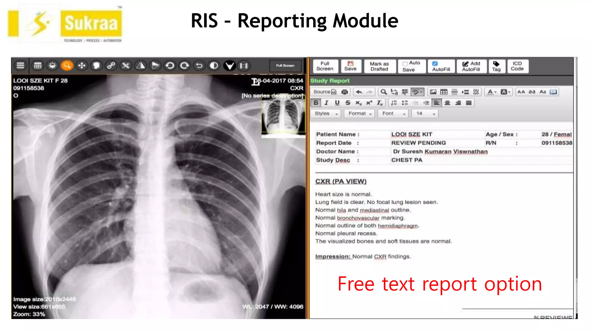 Sukraa clinical system | PPTX