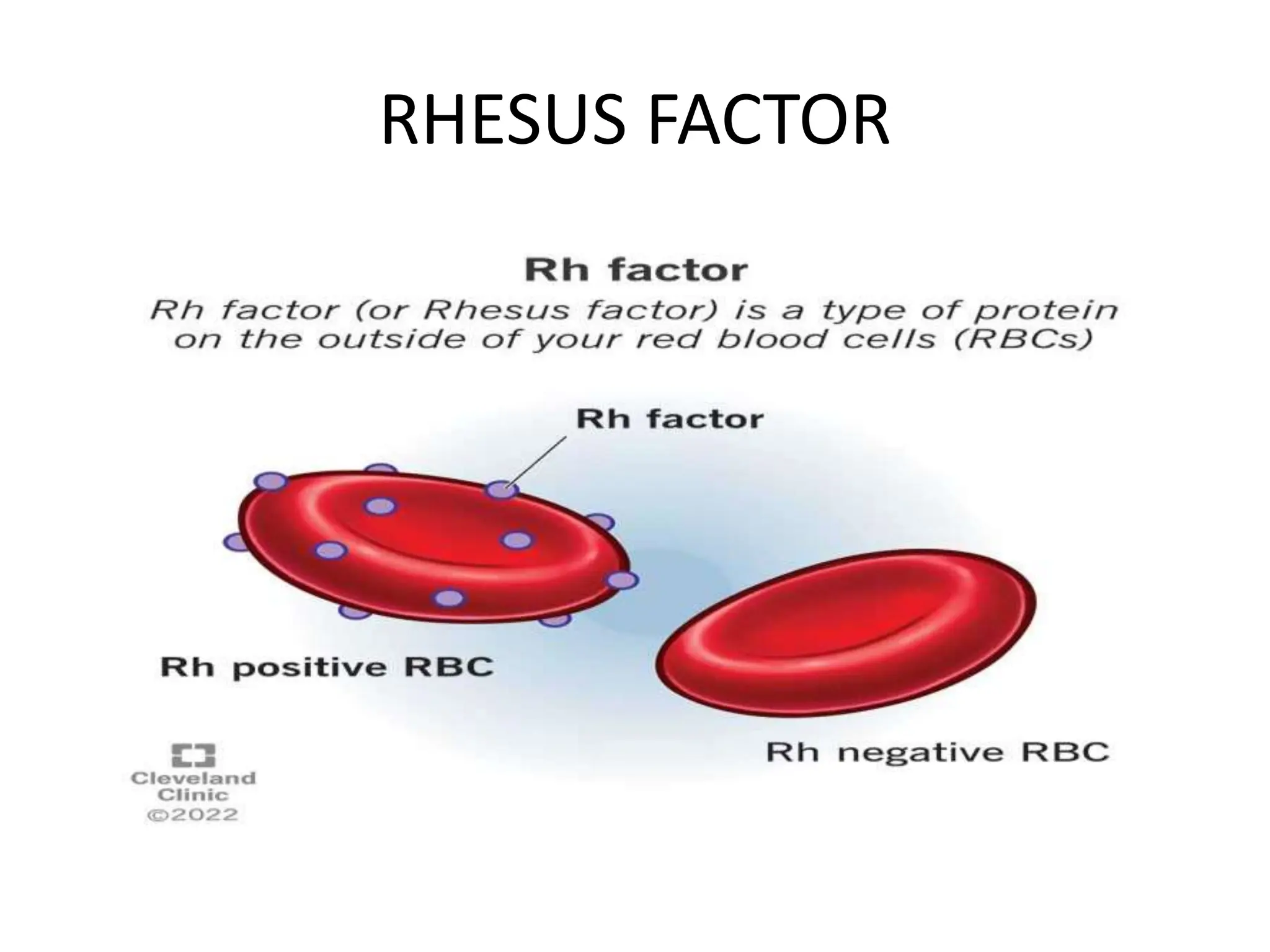 sukruthi rh neg.pptx obstetrics and gynaecology | PPTX