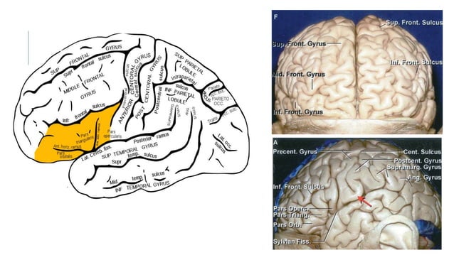 Sulcal anatomy supratentorial brain, excluding the temporal lobe. | PPTX