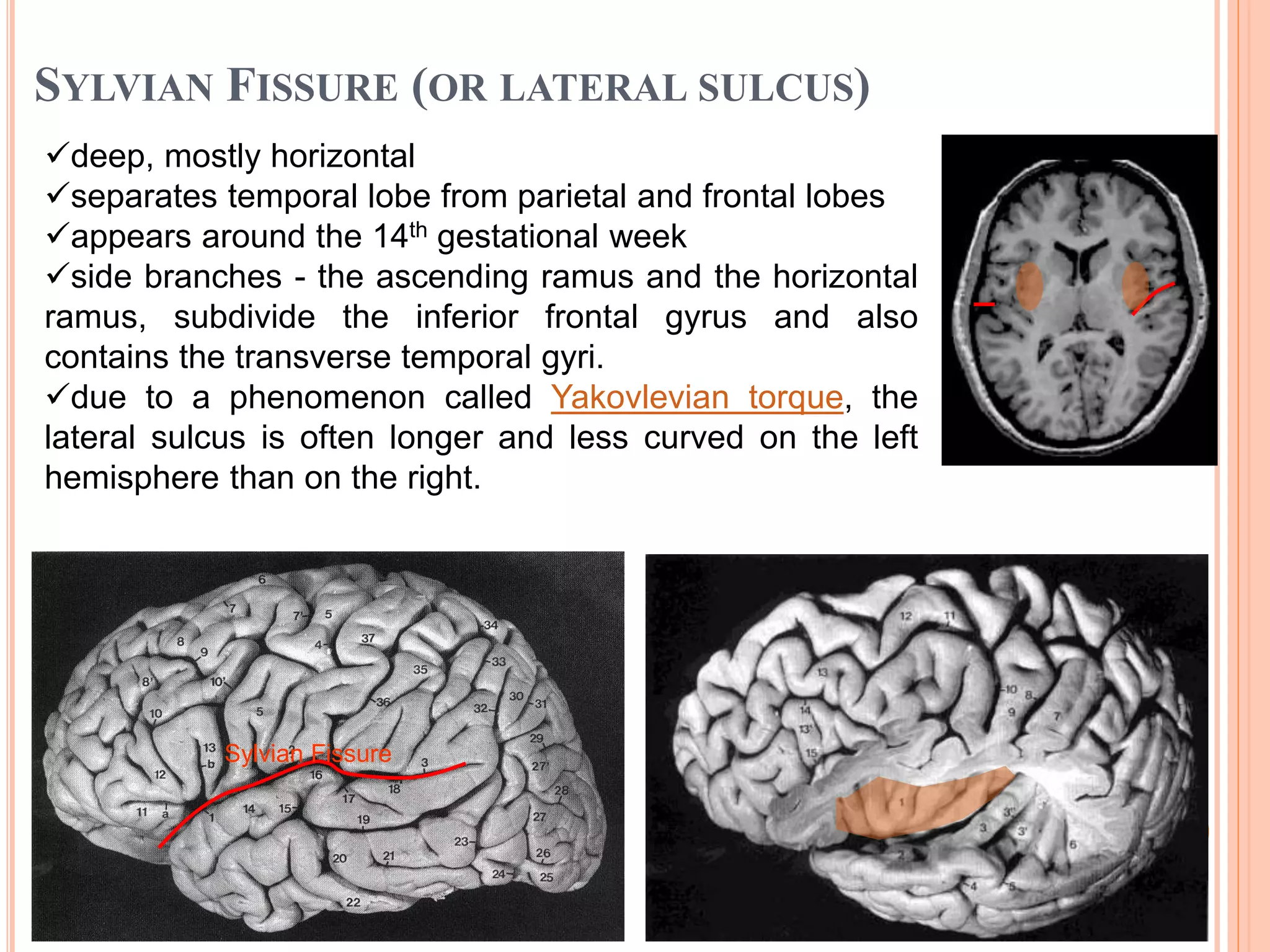 Sulcal and gyral neuroanatomy | PPTX