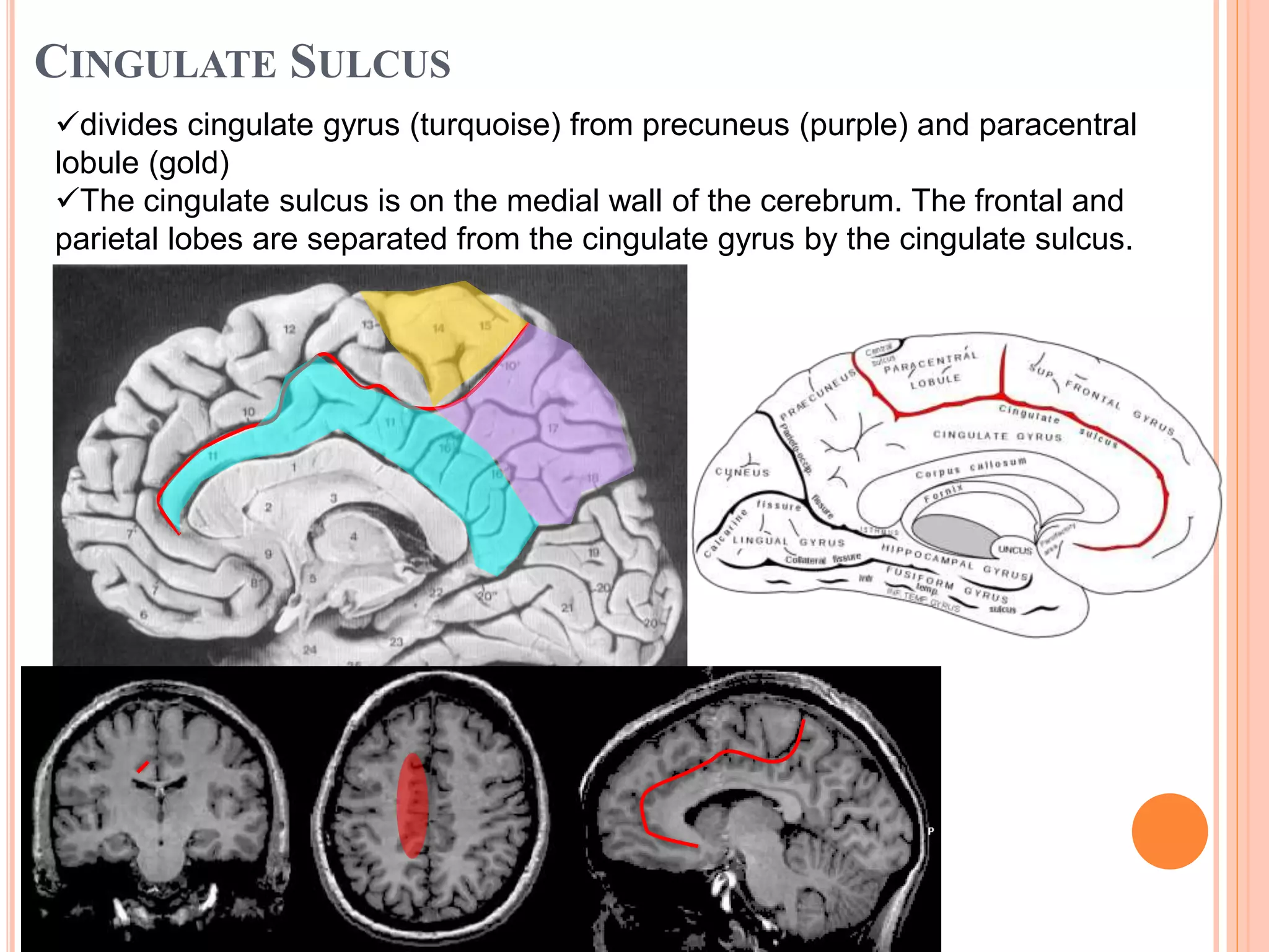 Sulcal and gyral neuroanatomy | PPTX