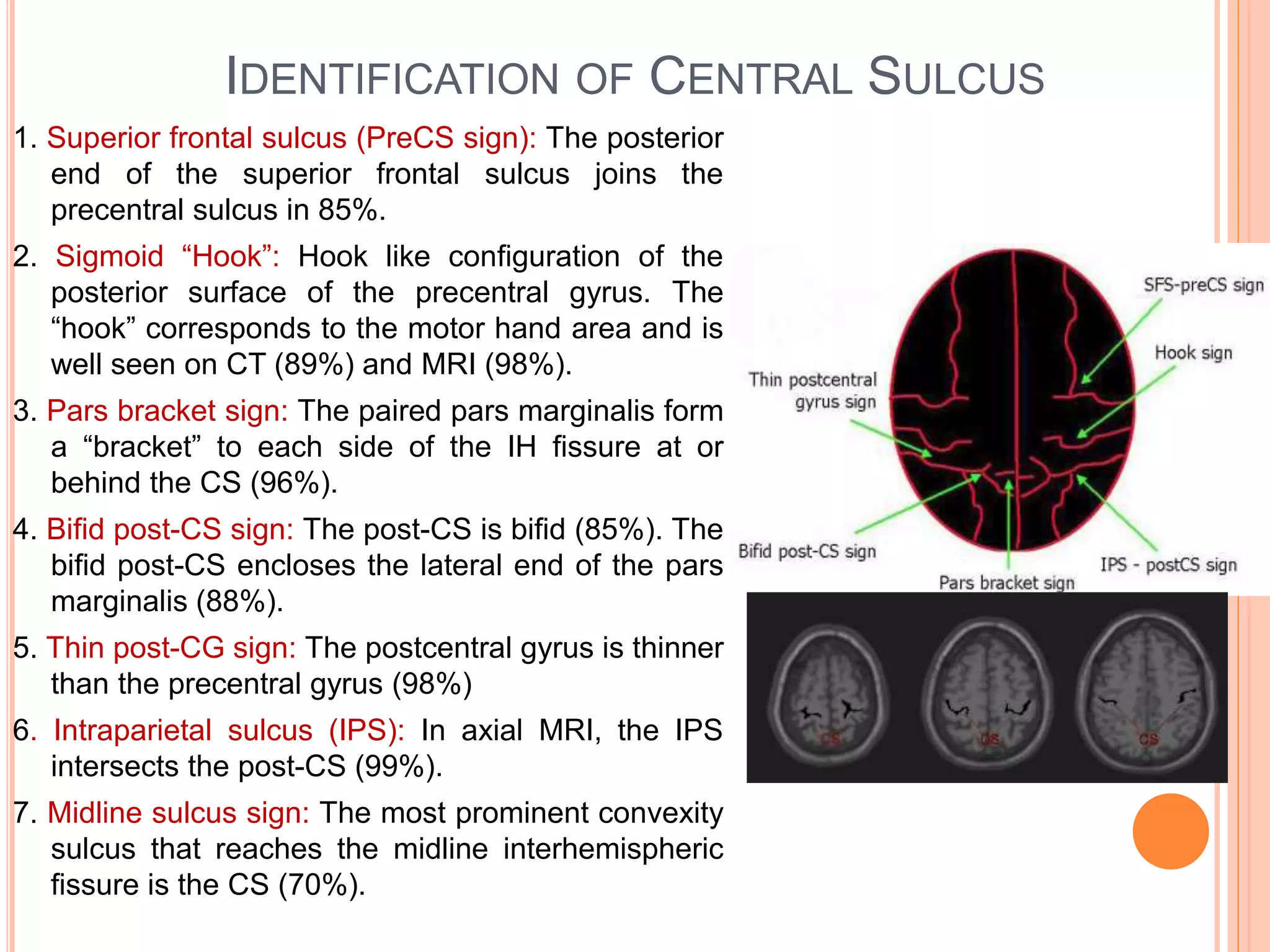 Sulcal and gyral neuroanatomy | PPTX