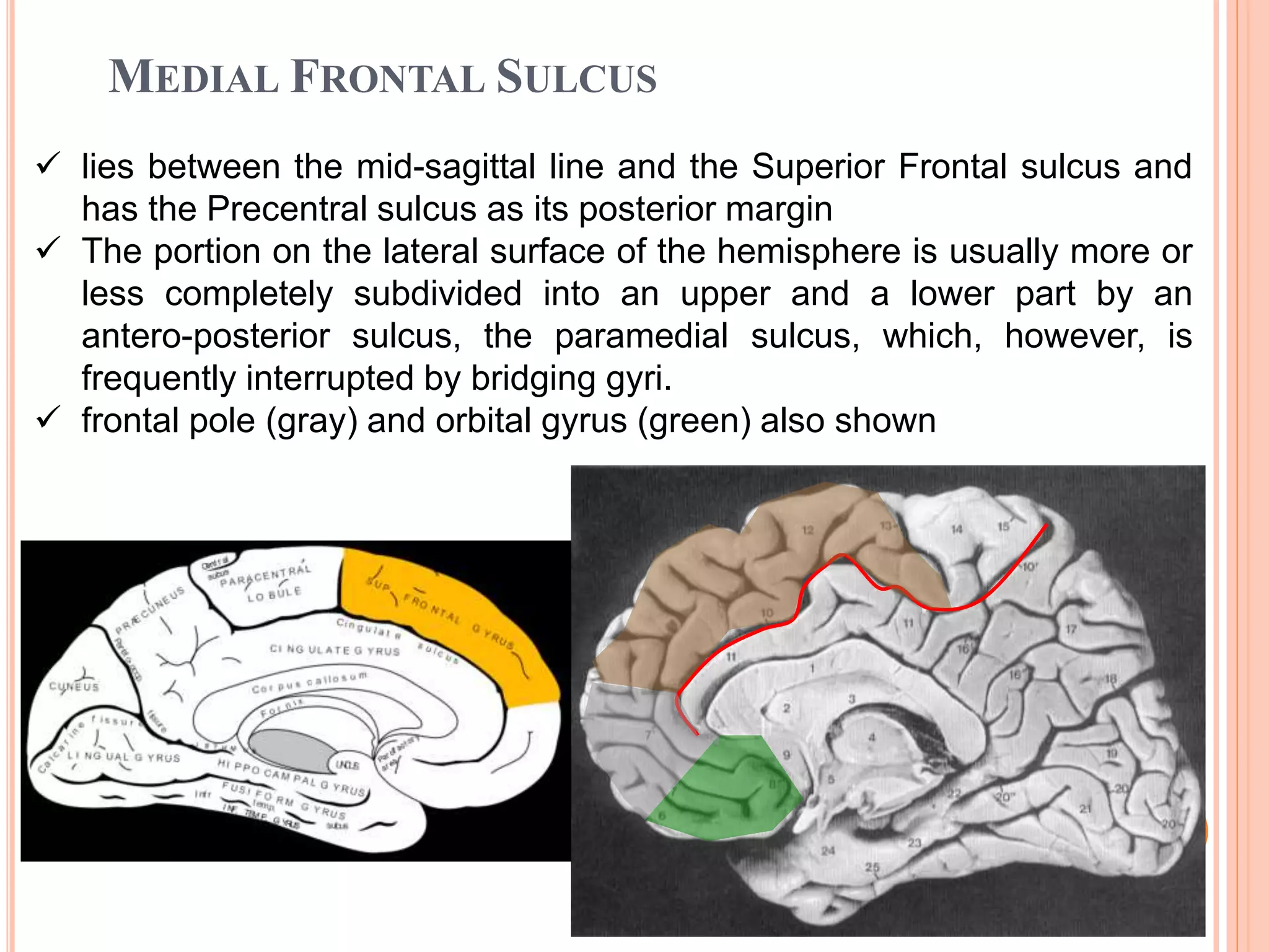 Sulcal and gyral neuroanatomy | PPTX