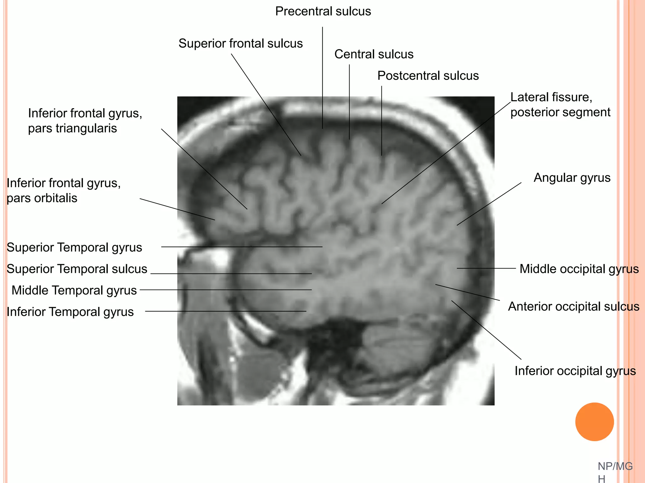 Sulcal and gyral neuroanatomy | PPTX