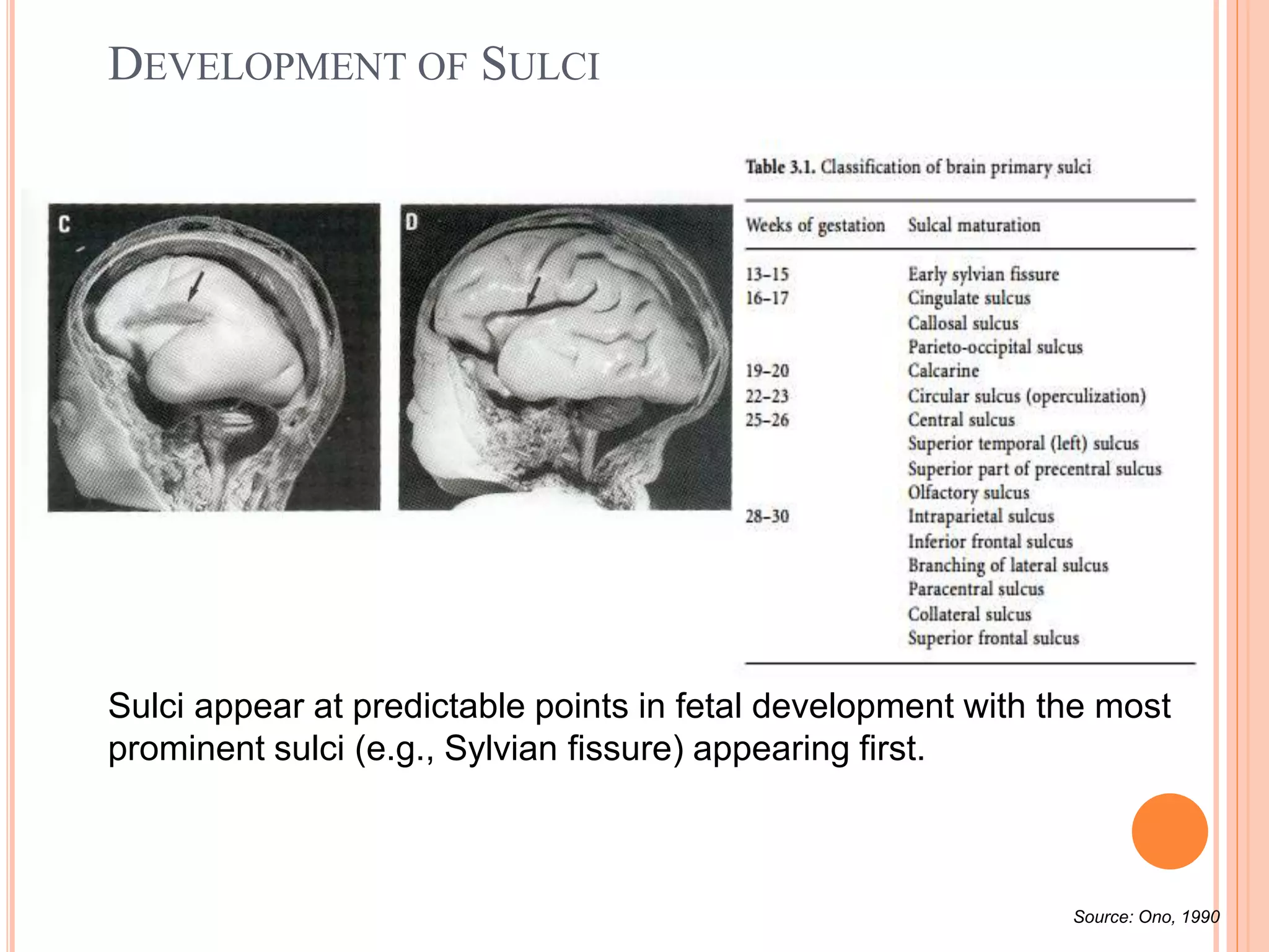 Sulcal and gyral neuroanatomy | PPTX
