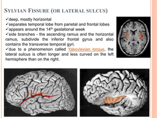 Transverse Sulcus