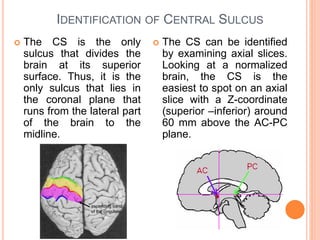 Central Sulcus