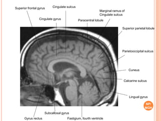 Cingulate Sulcus