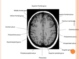 Postcentral Gyrus Mri