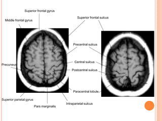 Mri Paracentral Lobule