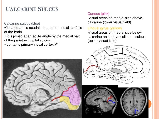Sulcal and gyral neuroanatomy