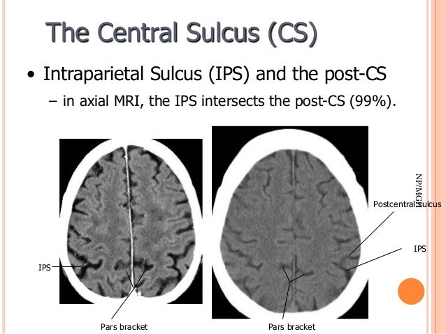 Intraparietal Sulcus Function