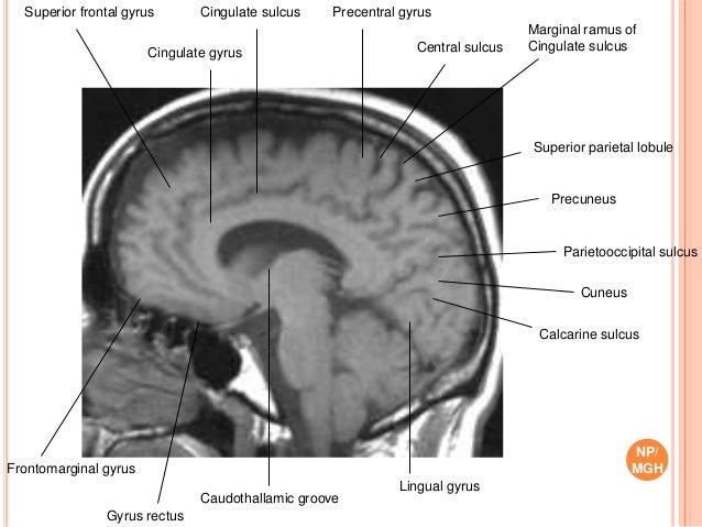 Sulcal and gyral neuroanatomy