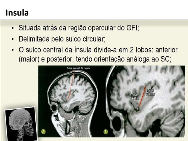 Sulcos e giros - Anatomia | PPTX | Brain and Nervous System Disorders ...
