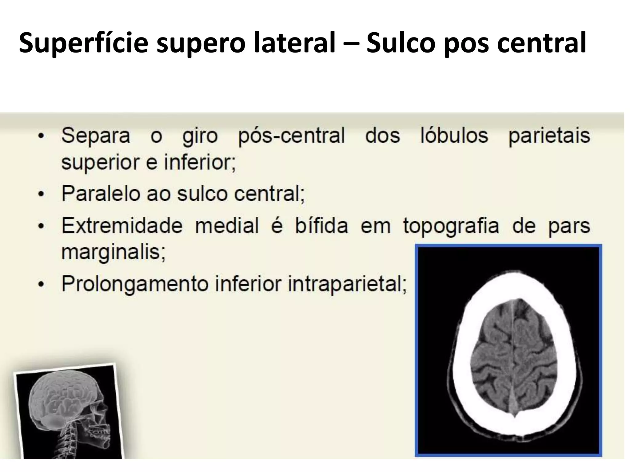 Sulcos e giros - Anatomia Aplicada | PPTX