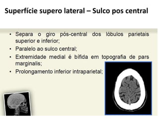 Sulcos e giros - Anatomia Aplicada | PPTX