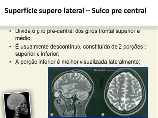 Sulcos e giros - Anatomia Aplicada | PPTX